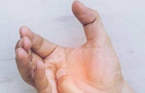 Nerve Injury In The Hand - This Quarterly