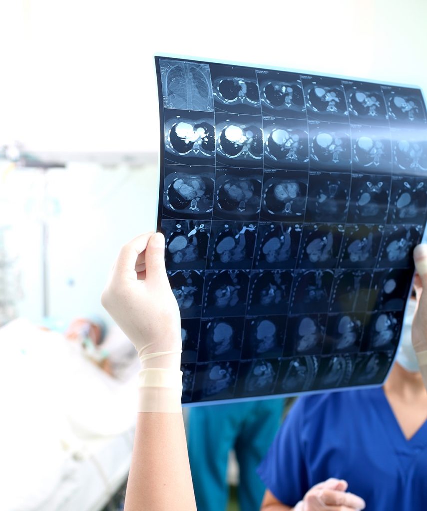 Scans: Pet vs Spect - This Quarterly