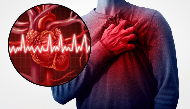 Coronary Artery Disease - This Quarterly