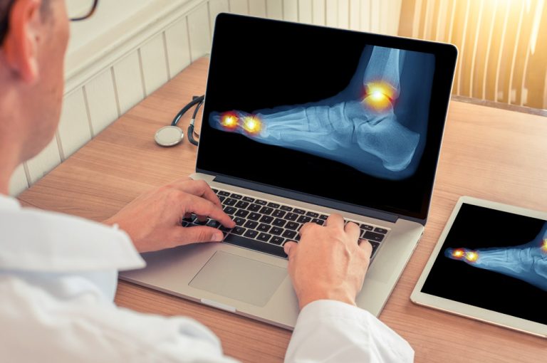 What Is Gout? - This Quarterly